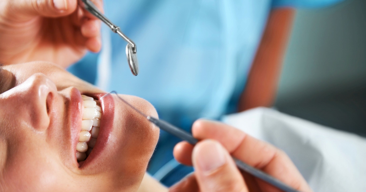 Deep Teeth Cleaning Rancho San Diego, CA | Simhairy Dental